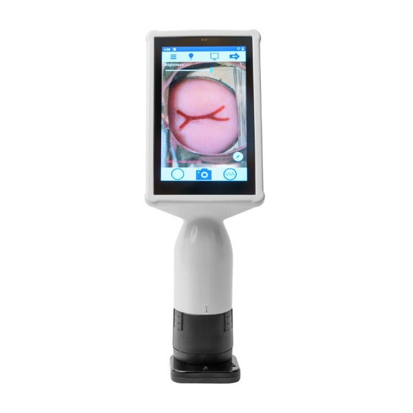 EVA Pro Mobile Digital Colposcope | FutureMed Global Pty Ltd